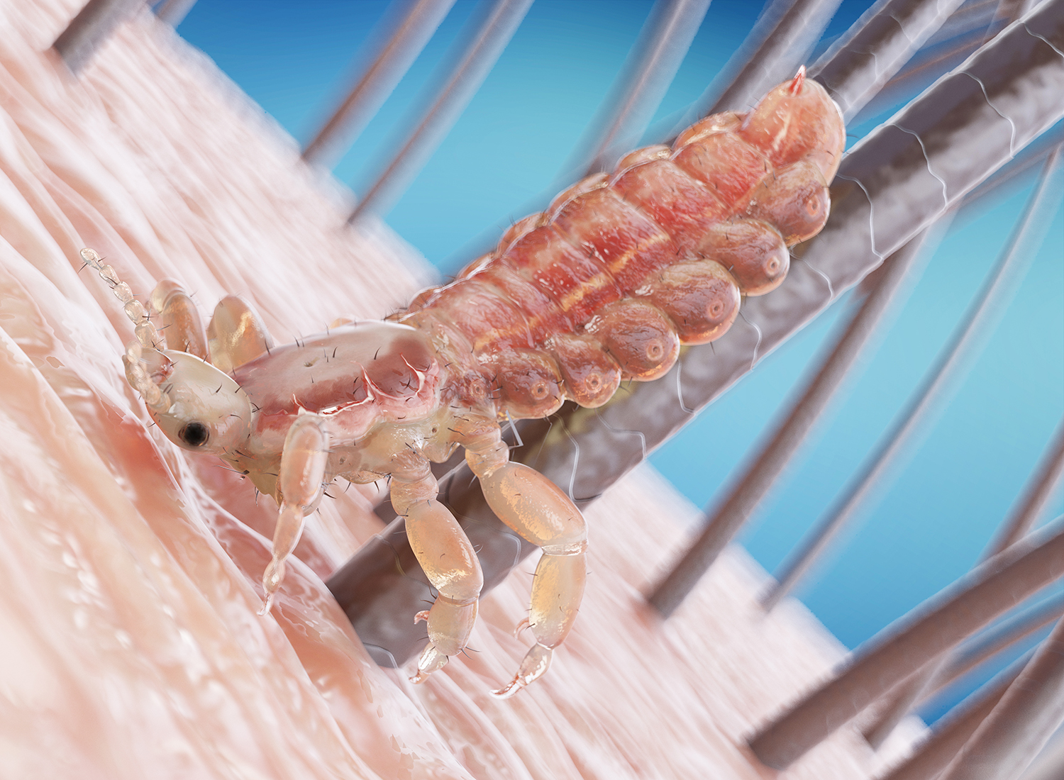 Vši a hnidy u dětí